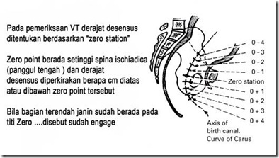 INFORMASI REPRODUKSI: KEMAJUAN PERSALINAN